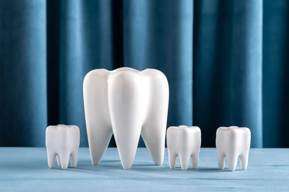 Dental Crown Replacement Procedure | Complete Guide