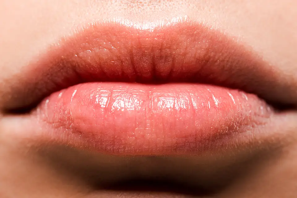 Lip Swelling: What Causes Lips To Swell? 7 Causes Explained